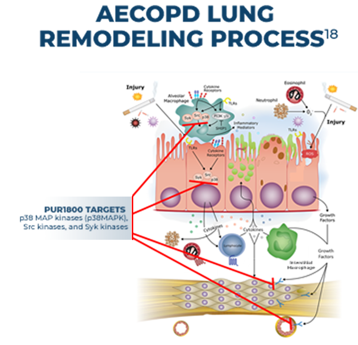Pipeline - PULMATRiX